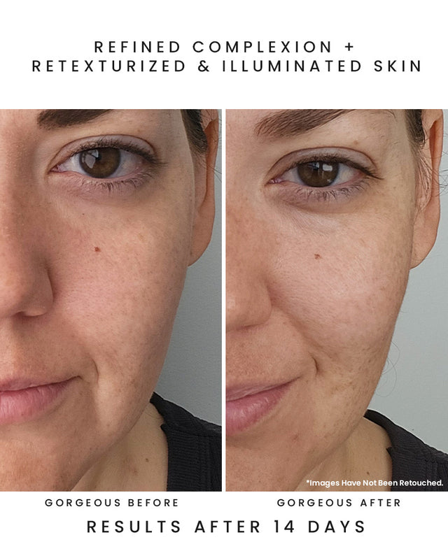 LUNA RAIN 15-Acid Resurfacing Serum – Earth Harbor Naturals